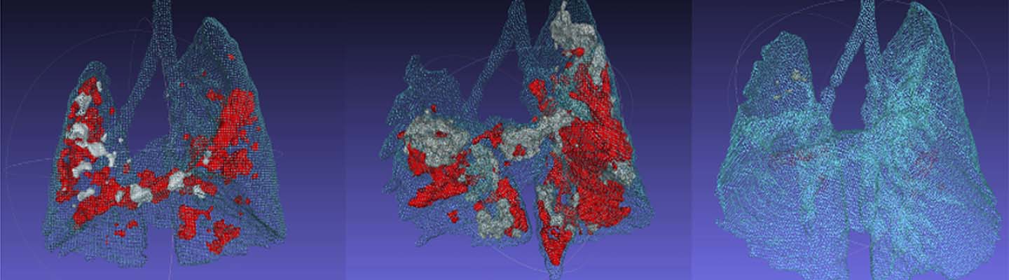 CTI Home: Center for Translational Imaging: Feinberg School of Medicine
